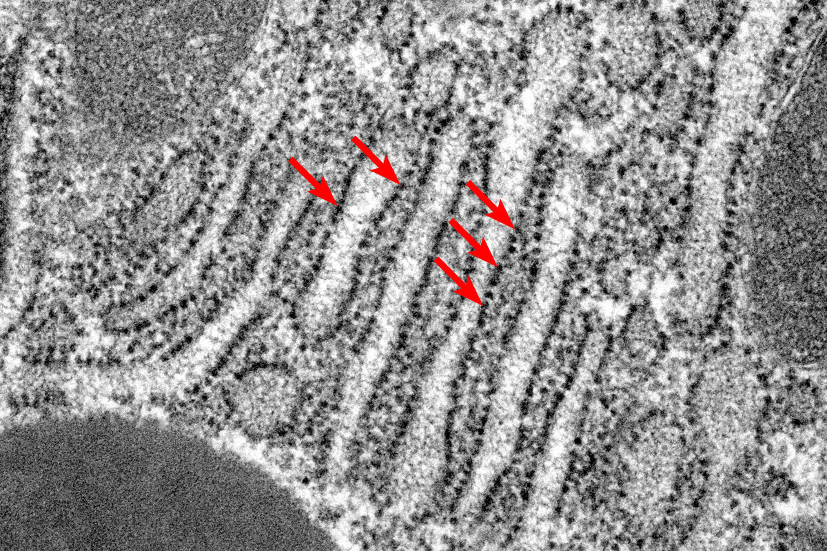 DAT - DAT Question of the Day: Cell Biology – Ribosomes | DAT Destroyer ...